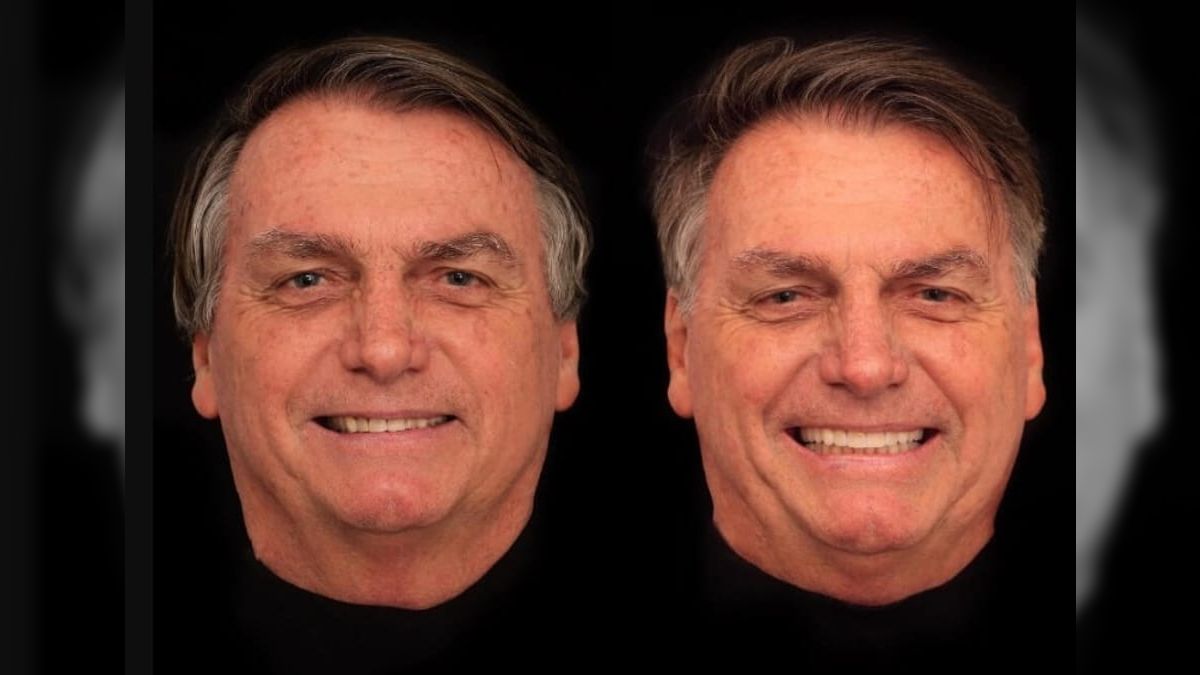 José Simão sobre harmonização de Bolsonaro: Ficou bonito para foto de ...