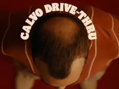 Veja qual tipo de calvo pode ganhar sanduíche de graça em promoção do ...